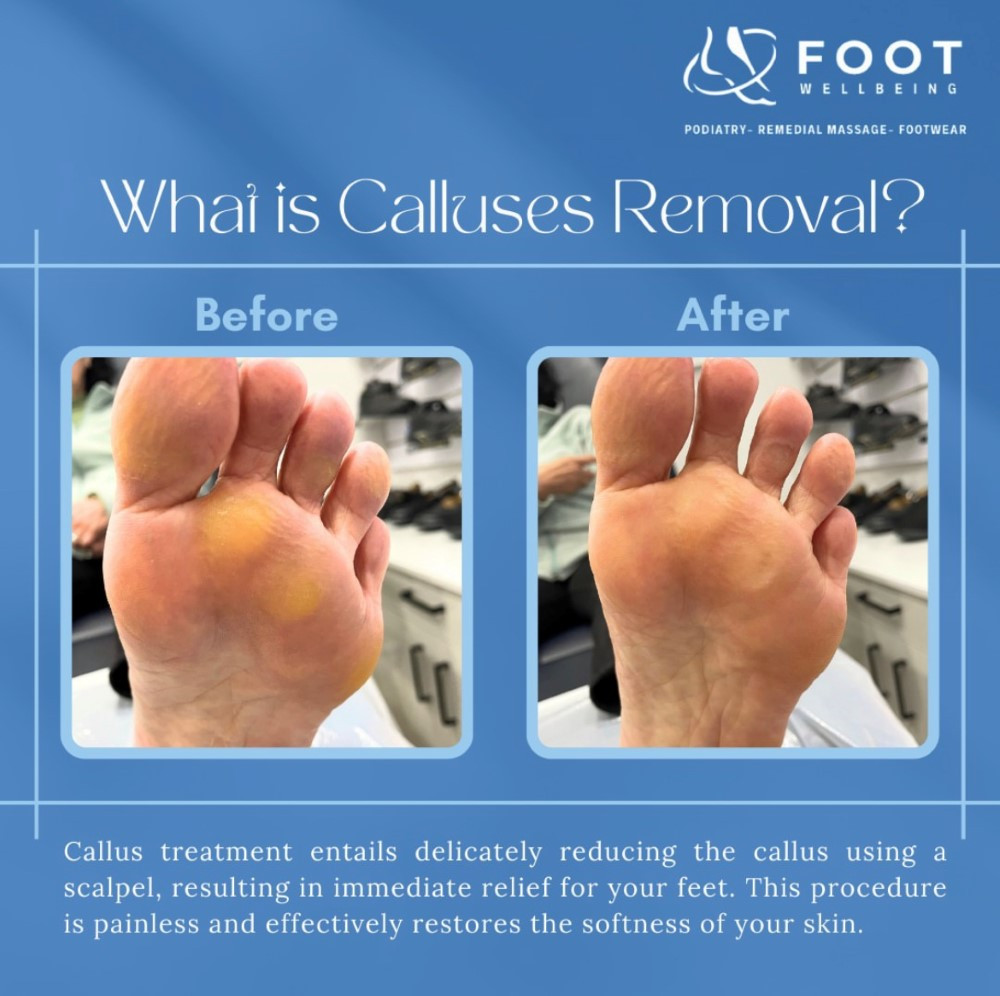 Podiatry Services | Foot Wellbeing - Podiatrists Footscray | Custom ...